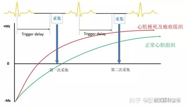 PSIR序列原理及临床应用 - 知乎