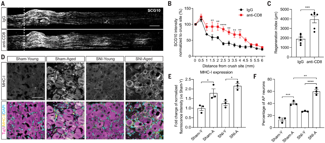 Science：为什么老年人神经损伤后难以恢复？可逆的CD8+ T细胞与神经元交流导致衰老依赖的神经再生衰退 - 知乎
