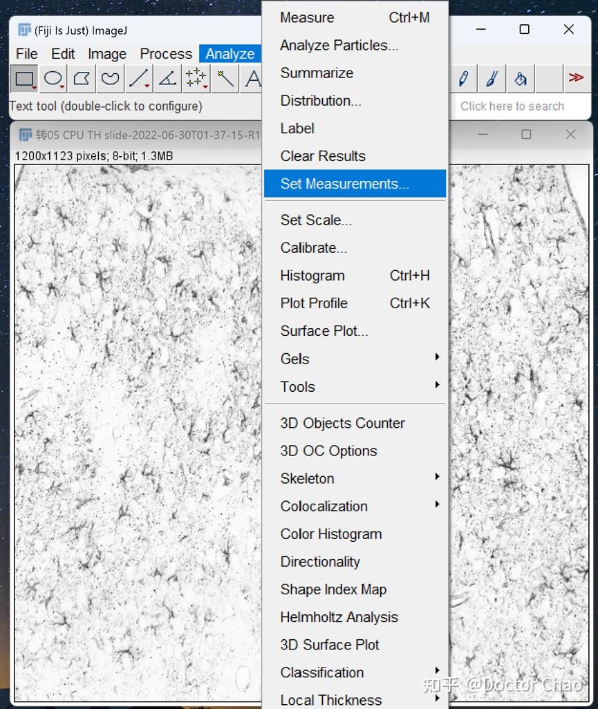 Image J 统计免疫组化片子阳性信号的平均光密度值教程 - 知乎