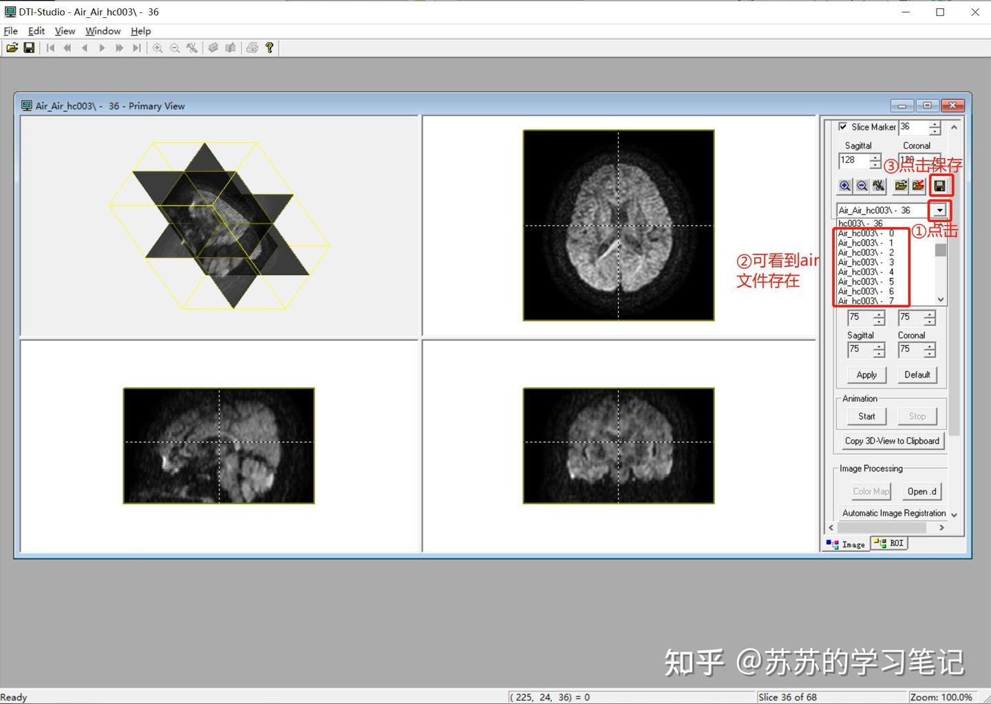 DTI Studio操作教程 - 知乎