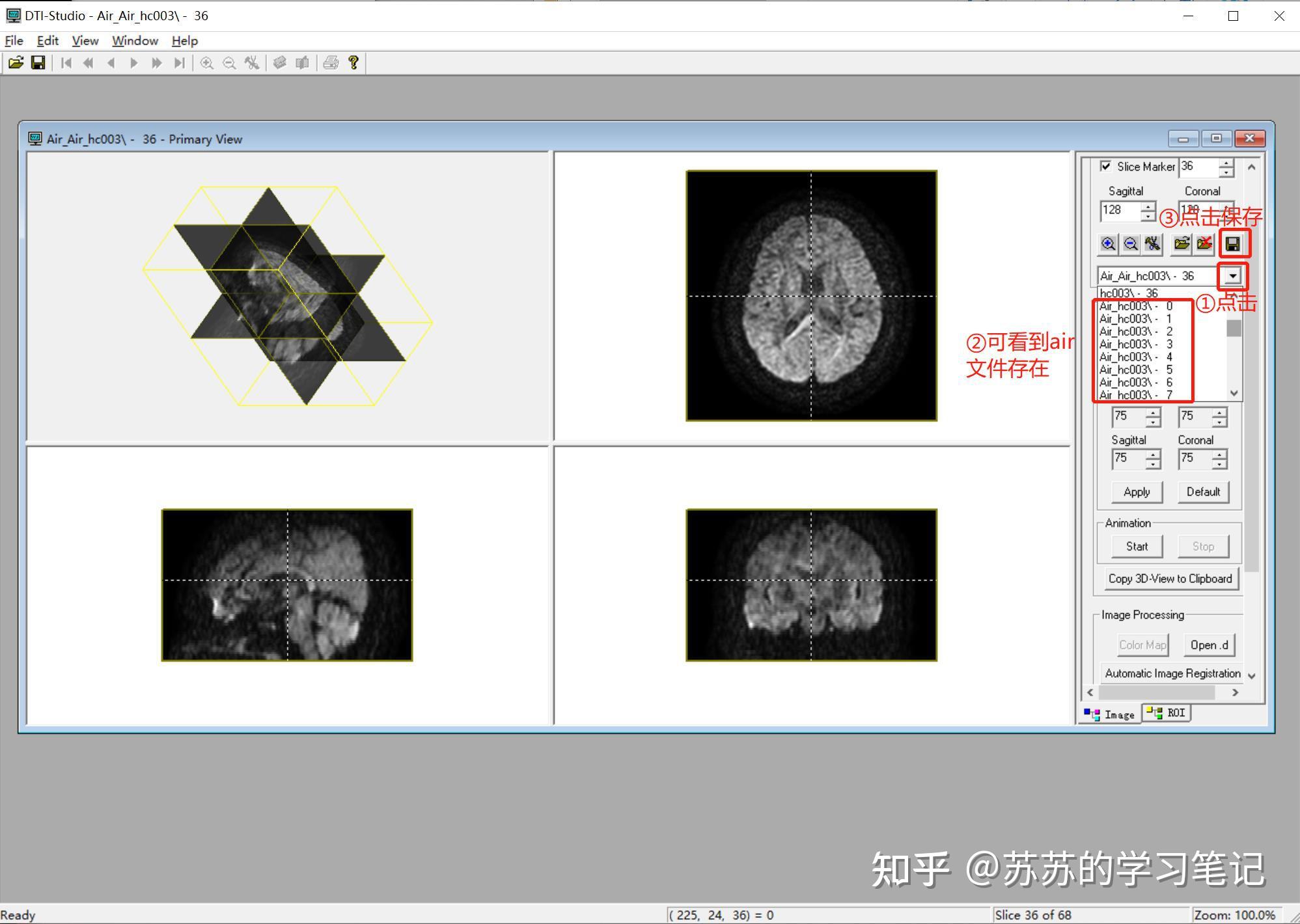 DTI Studio操作教程 - 知乎