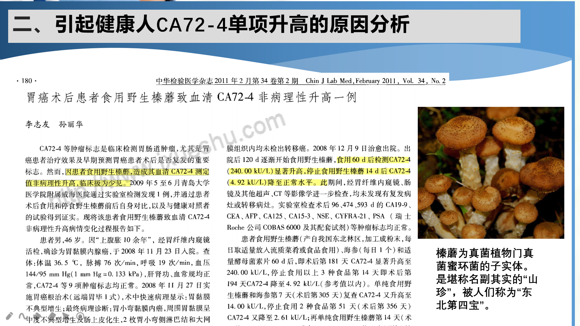 ca72-4单项指标高严重吗? - 知乎