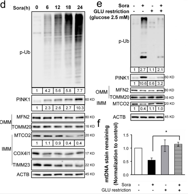Exp Mol Med︱卢国栋/沈汉明/彭涛团队发现索拉非尼联合葡萄糖限制促进肝癌细胞死亡的新机制 - 知乎