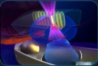 150亿细分赛道！专注于前列腺肿瘤消融的海扶刀公司Sonablate - 知乎