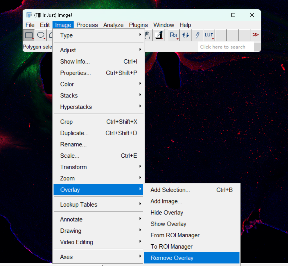ImageJ Overlay：如何隐藏、显示和导出 - 知乎
