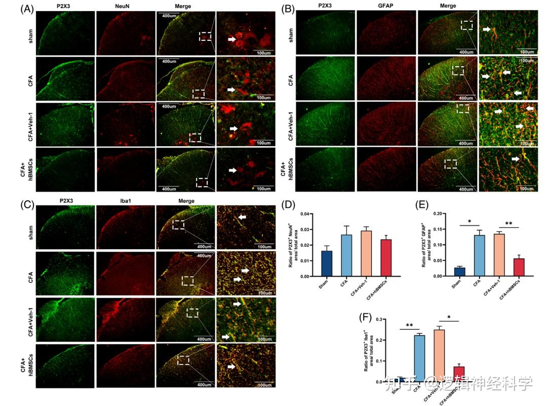 Cell Prolif︱中山大学李响/原冬冬团队合作揭示骨髓间充质干细胞治疗炎性疼痛的作用及机制 - 知乎