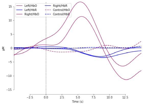 MNE/Python-fNIRS近红外数据处理中文手册 - 知乎