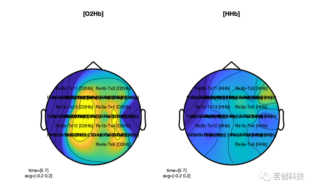 教程 | 多通道fNIRS数据的预处理和平均（下） - 知乎