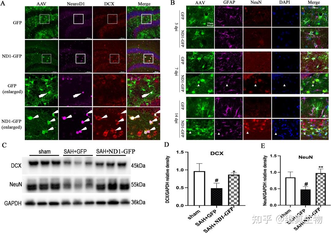 J Neuroinflamm：叶祖承/康德智/林清松团队揭示NeuroD1改善蛛网膜下腔出血小鼠的神经炎症并促进神经发生 - 知乎