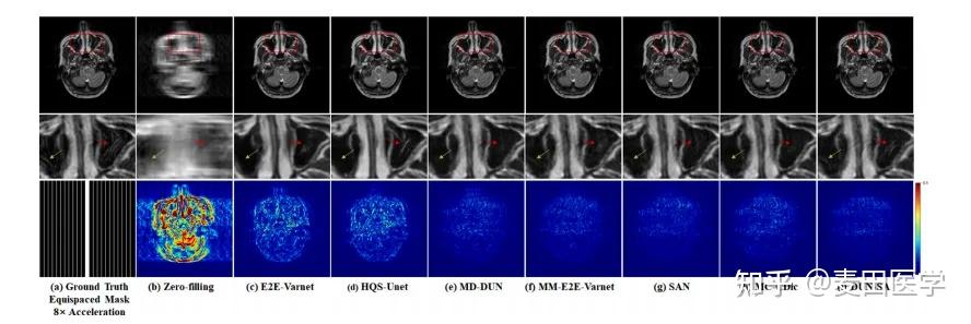 用于多模态MRI重建的具有空间对齐的深度展开网络|文献速递--基于多模态-半监督深度学习的病理学诊断与病灶分割 - 知乎