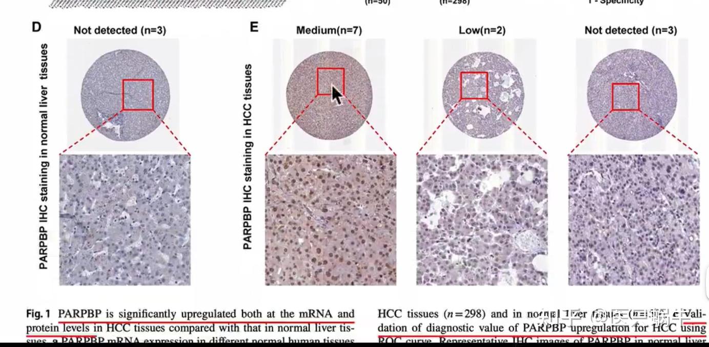 TCGA数据分析全攻略（第二期）【笔记】 - 知乎