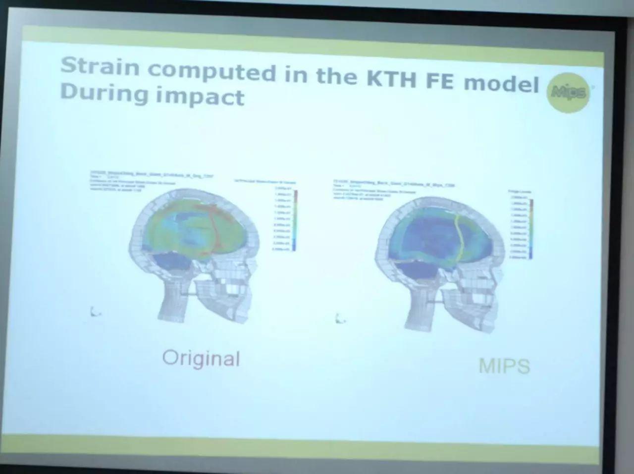 MIPS究竟为何物？详解MIPS头盔保护系统 - 知乎