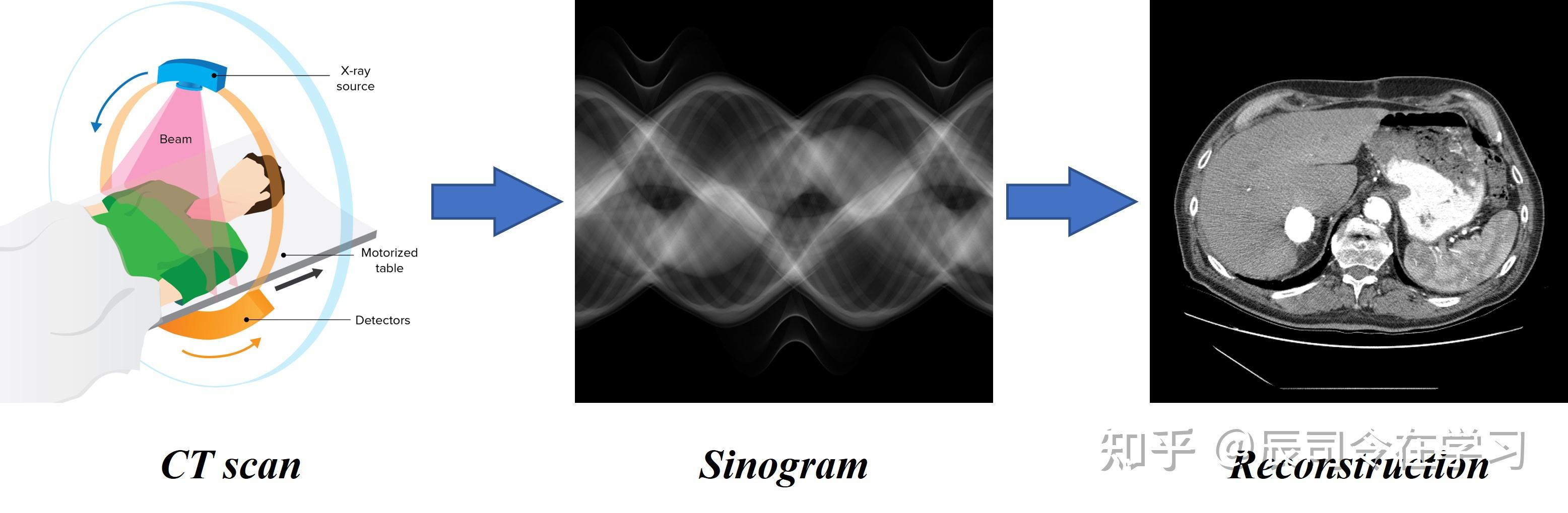 反问题层析重建讨论（Inverse Problems for Tomography） - 知乎