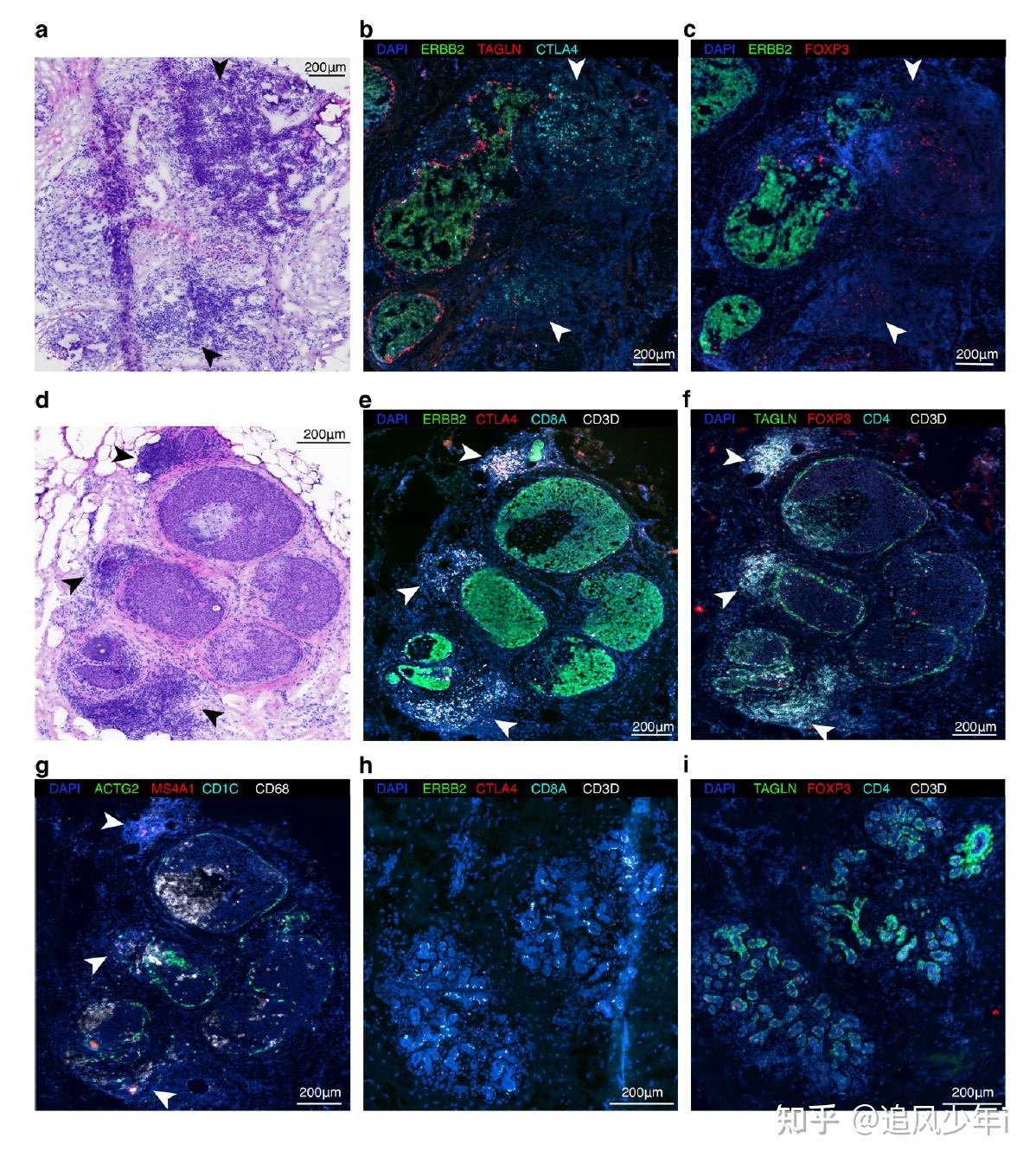 10X单细胞空间联合分析之十一（CellTrek） - 知乎