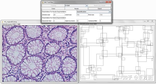 ImageJ | 免疫组织化学（IHC）图像分析工具箱 | 下载地址 | 安装教程 | 使用教程 - 知乎