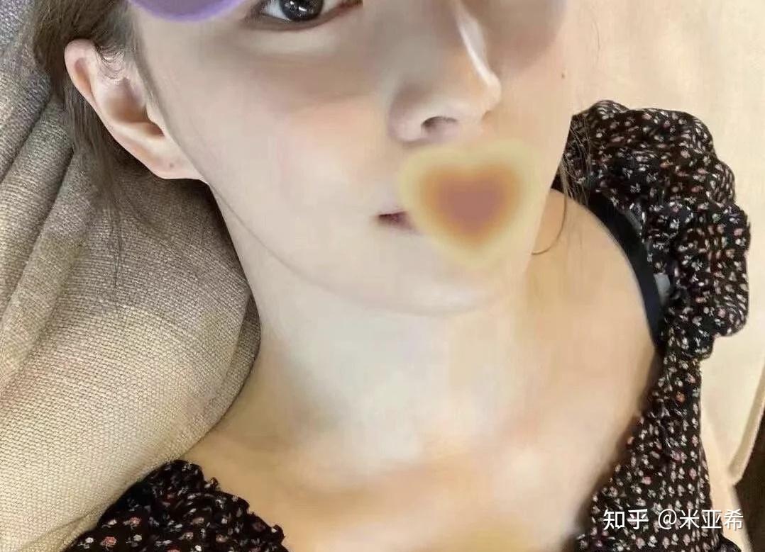吃什么能让皮肤变好? 知乎