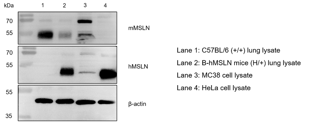 扬帆起航：MSLN靶点治疗带来抗癌治疗“新生机” - 知乎