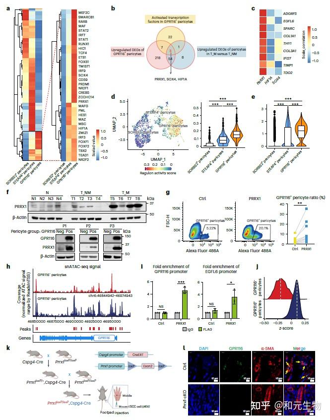 Nature genetics| ESCC GPR116+周细胞通过PRRX1-EGFL6-整合素β1-NF-kB轴调控肿瘤转移 - 知乎