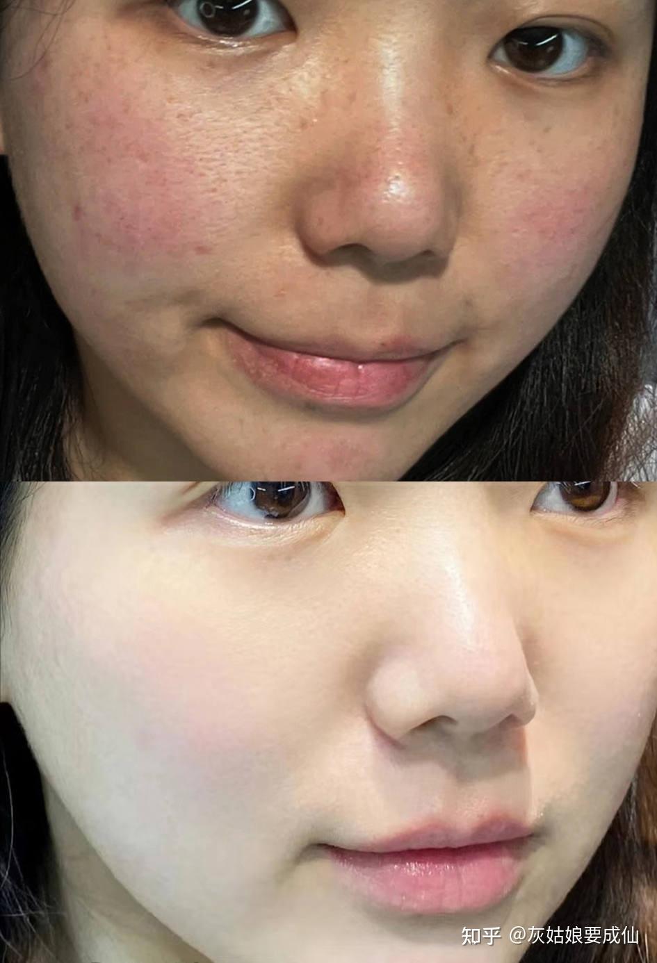 你用过哪些【惊为天人】的美白产品?中科院研发的谷雨美白面霜,亲测2个月皮肤白到发光,效果太猛了! 知乎