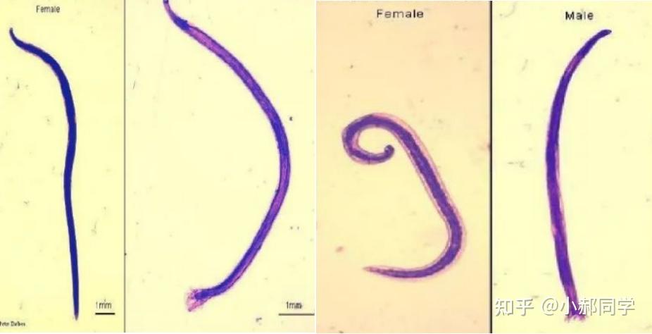 卫生资格考试检验专业(寄生虫学检验部分)消化道寄生虫章节考点都有哪些？ - 知乎