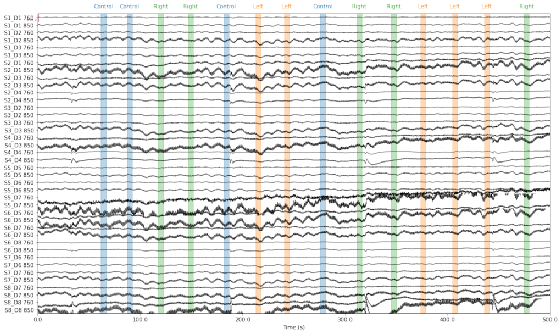 MNE/Python-fNIRS近红外数据处理中文手册 - 知乎