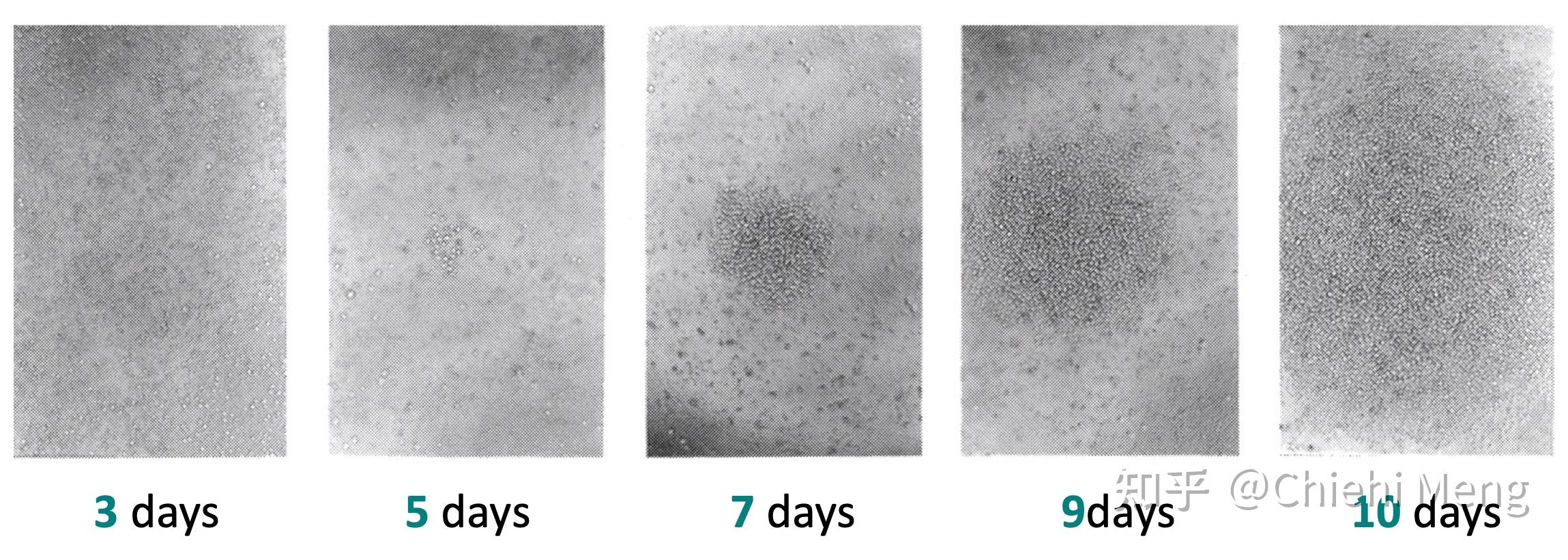 手把手教你制作单克隆抗体（实验室制备抗体） - 知乎
