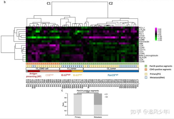 DSP(Digital Spatial Profiler)技术在神经内分泌肿瘤方面的运用 - 知乎