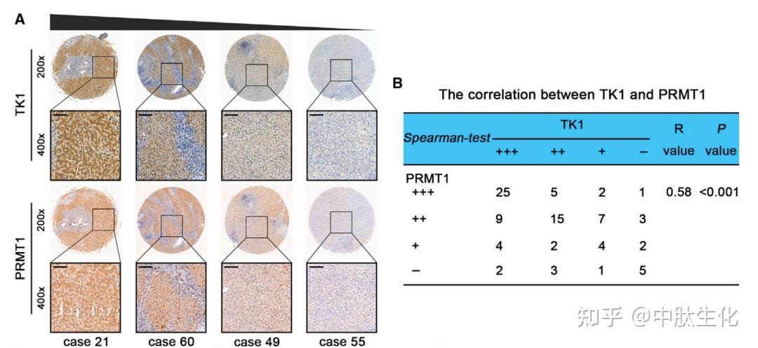 《细胞·代谢》：南医大/武大团队发现肝癌代谢重编程的新机制！ - 知乎
