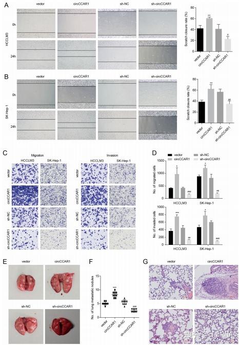Mol Cancer丨李立教授发现circCCAR1促进肝细胞癌CD8+T细胞功能紊乱和耐药性 - 知乎