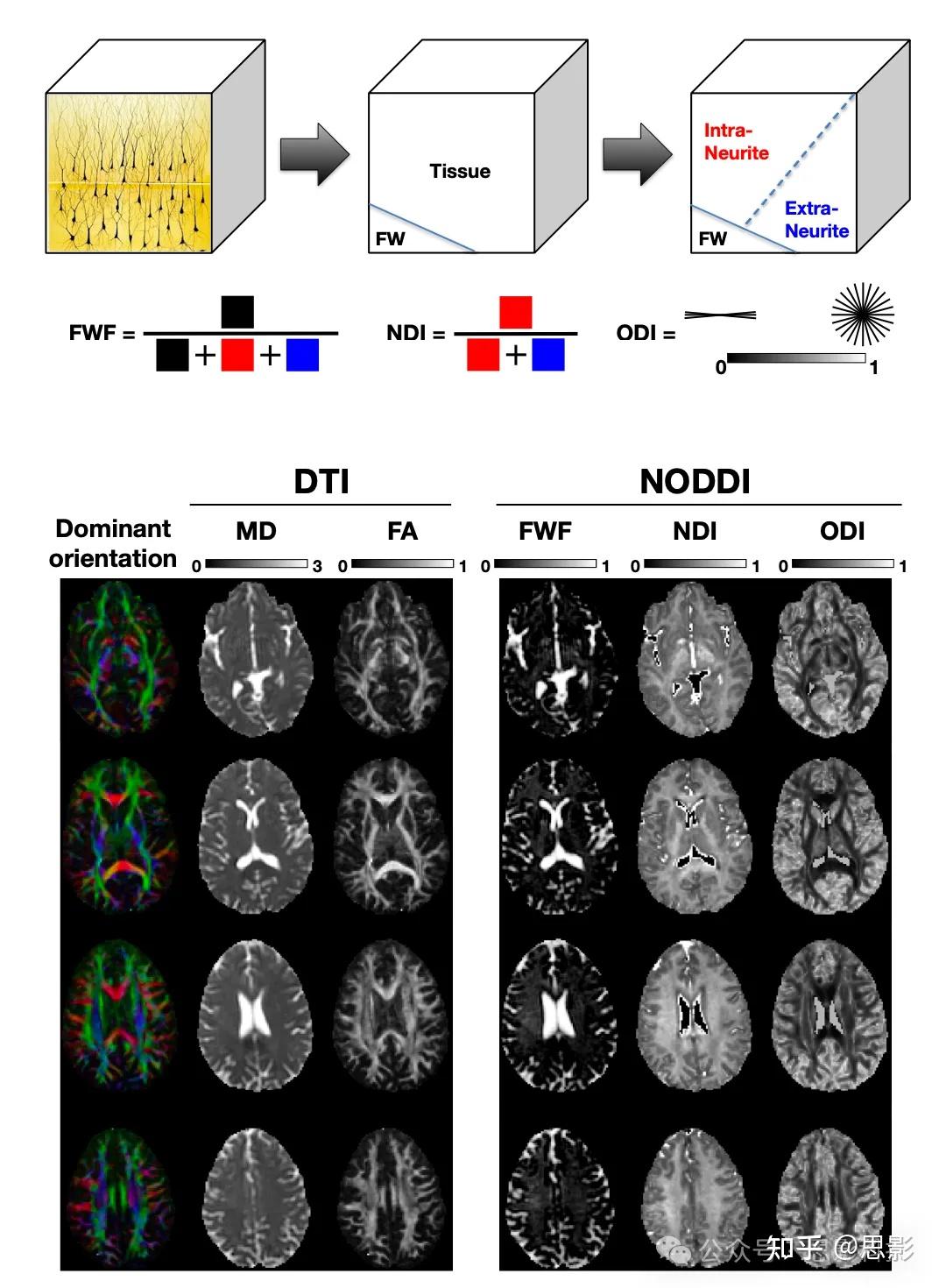 精神障碍中的神经突方向离散度和密度成像（NODDI) - 知乎