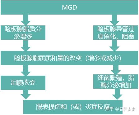 MGD与干眼症：从病因到疗法的全面解析 - 知乎