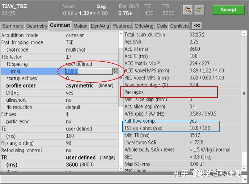 磁共振参数之回波间隔 - 知乎