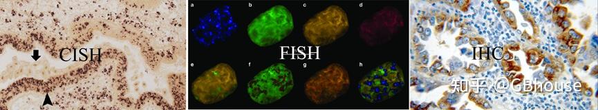 显色原位杂交CISH实验原理与基本实验操作 - 知乎