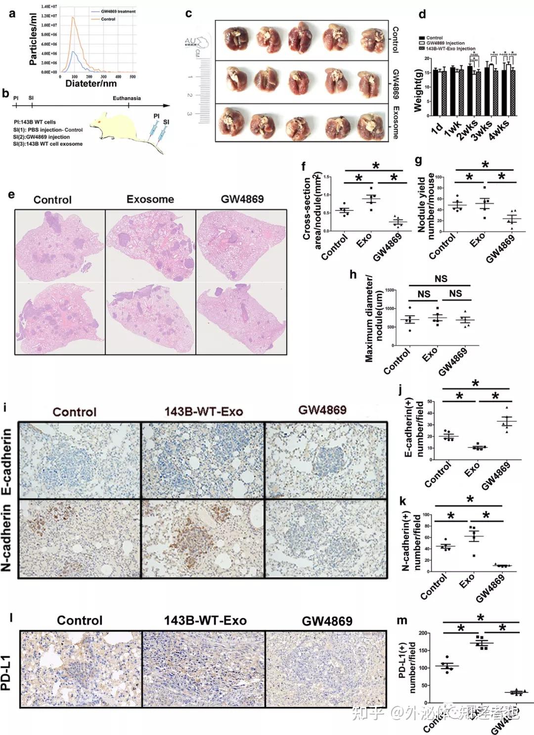 骨肉瘤外泌体研究有哪些成功案例？ - 知乎