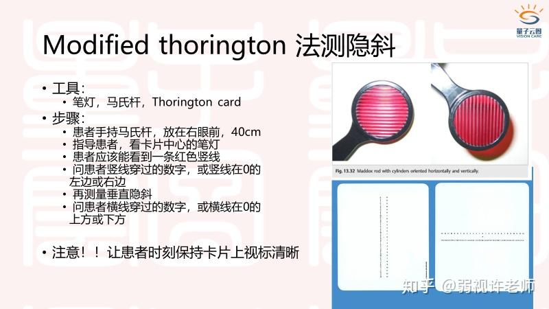 干货，隐斜检查系列（三）——安利一种傻瓜式隐斜检查方法，一分钟就能学会 - 知乎