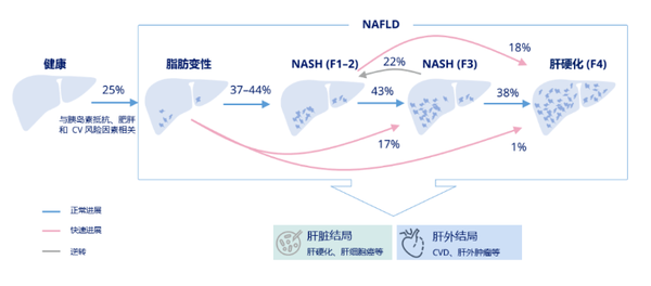 盘点 | NAFLD/NASH全球在研药物进展 - 知乎