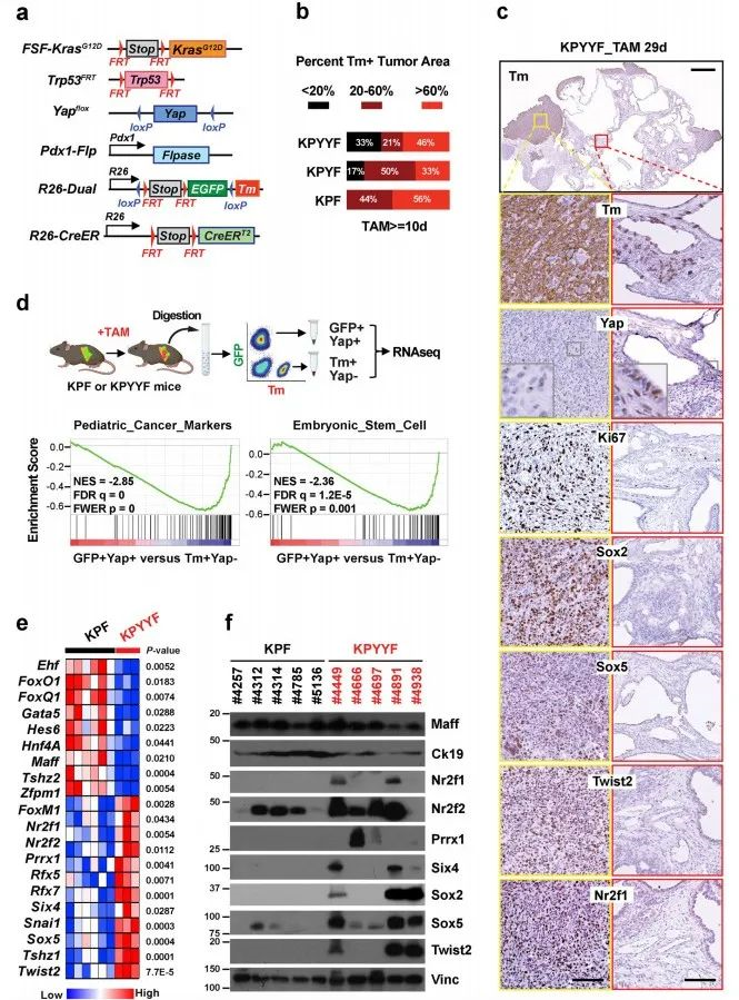Nature commu|晚期胰腺导管腺癌中自发进化的祖细胞niches逃避Yap癌基因成瘾 - 知乎