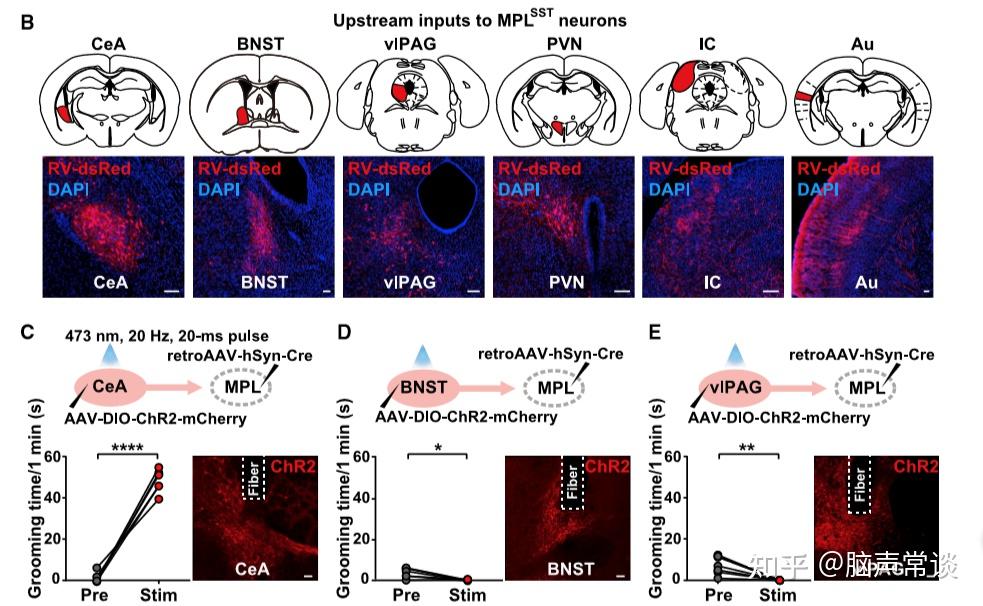 Neuron丨上海交通大学黄菊课题组CeA-MPL-VTA环路在自我梳理和应激后焦虑调节中的双重作用 - 知乎