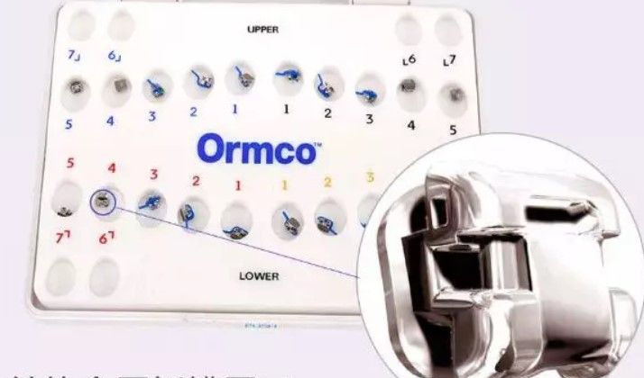 ao托槽和ormco托槽的区别：从优缺点/价格/适用人群对比分析 - 知乎