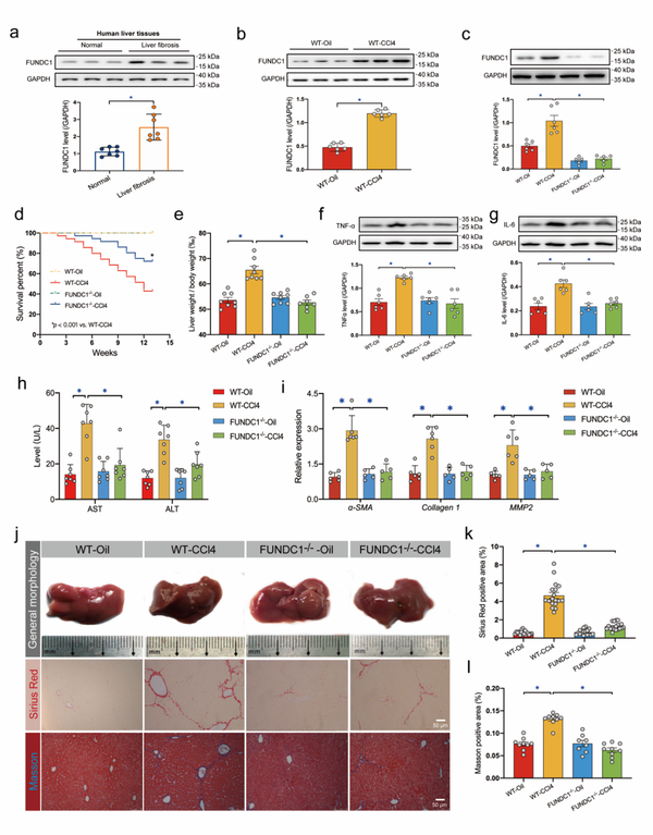 J Adv Res｜复旦大学中山医院团队阐述肝纤维化过程中线粒体自噬调控铁死亡的新机制 - 知乎