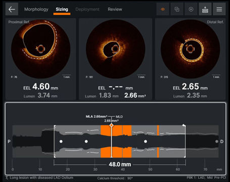 CCEC·前沿技术｜当人工智能“预见”OCT - 知乎