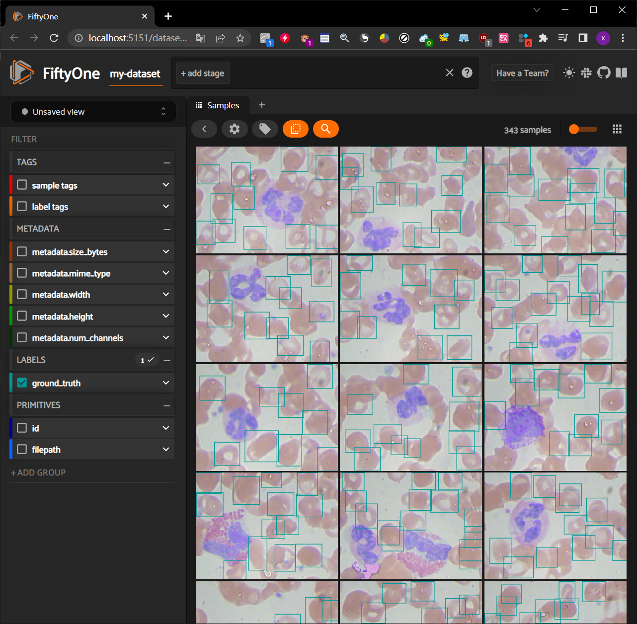 FiftyOne 系列教程（2）使用FiftyOne读取数据集 - 知乎