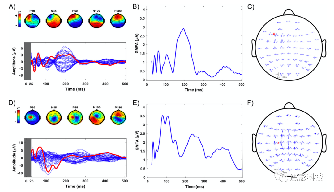 TMS-EEG的临床应用及展望 - 知乎