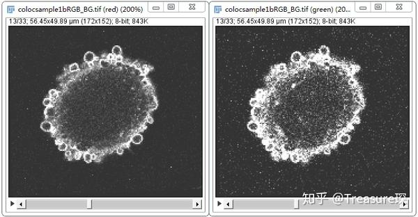 ImageJ实用技巧——荧光共定位分析(定量分析篇) - 知乎