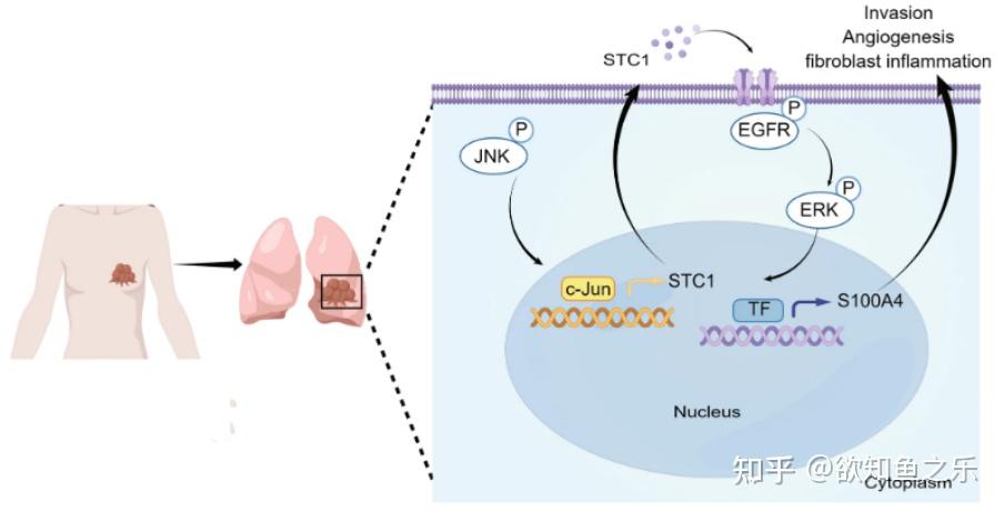 Stanniocalcin-1在乳腺癌肺转移中的作用机制 - 知乎