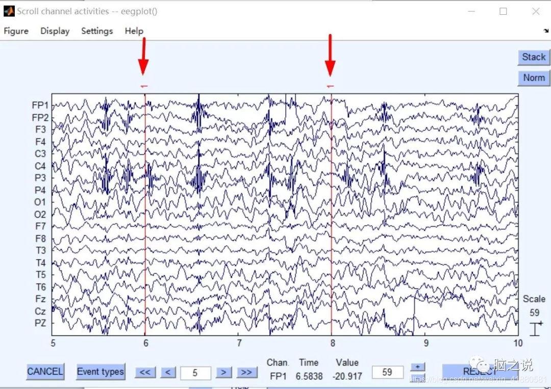 如何利用EEGlab工具包在EEG数据中手动插入Marker？ - 知乎