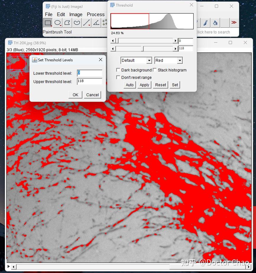组化片子如何利用Image J 进行阳性信号面积占比统计分析 - 知乎
