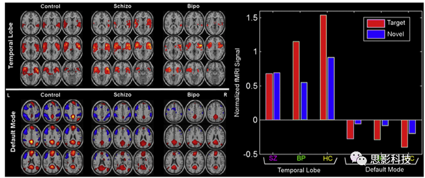 ICA在fMRI组水平推断和融合多模态数据方面的应用 - 知乎