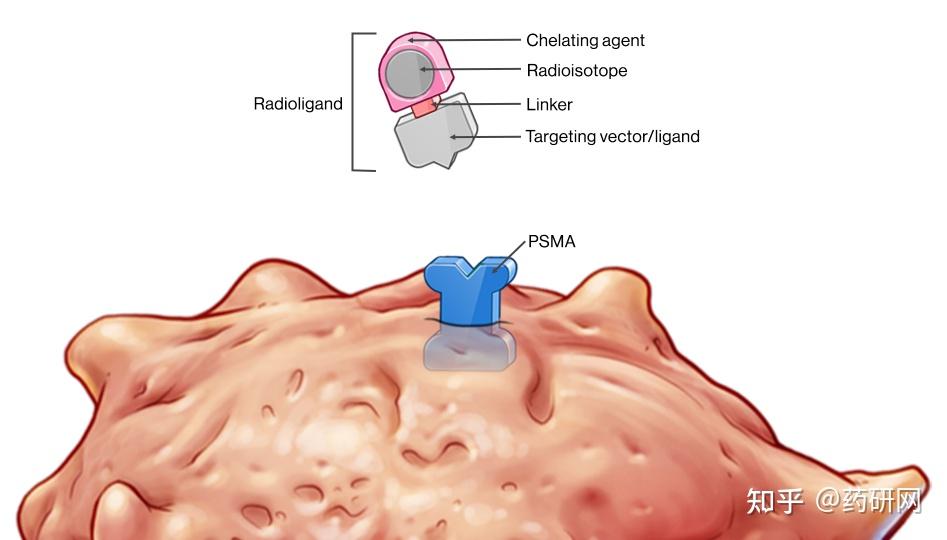 前列腺癌标志物：PSMA - 知乎