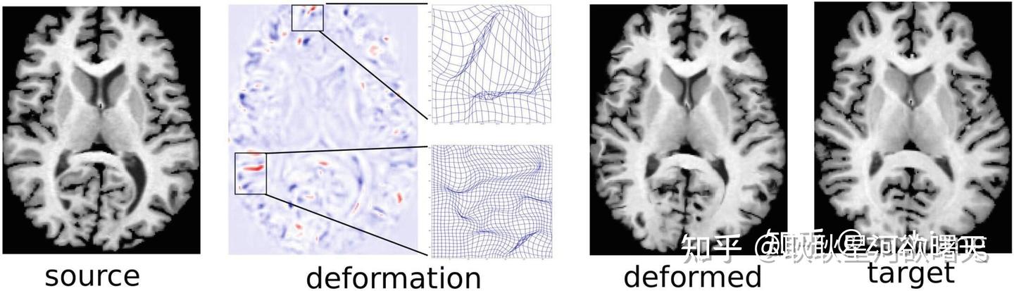[论文笔记] VoxelMorph - 知乎